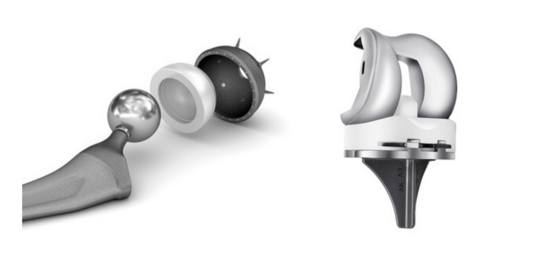 Joint Reconstruction, Part 2 – Material Standards - Rösler Group