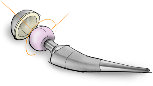 Surface Finishing for Medical technology - Rösler Group